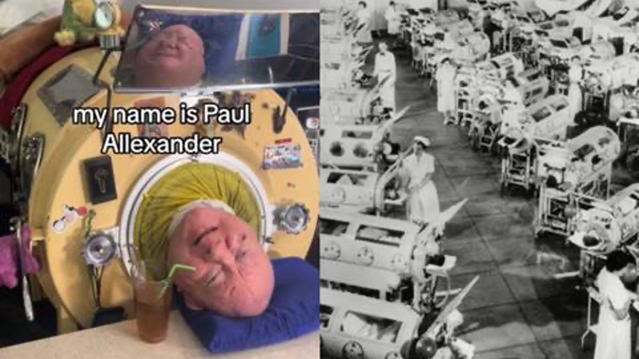 ¿Quién es Paul Alexander? el hombre que vivió 70 años con un pulmón de ...