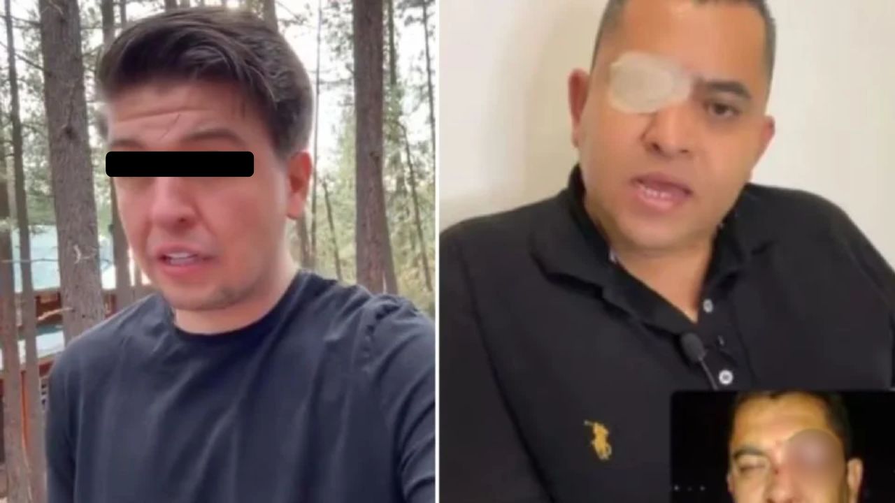 Exescolta asegura haber perdido un ojo después de sufrir una agresión ...